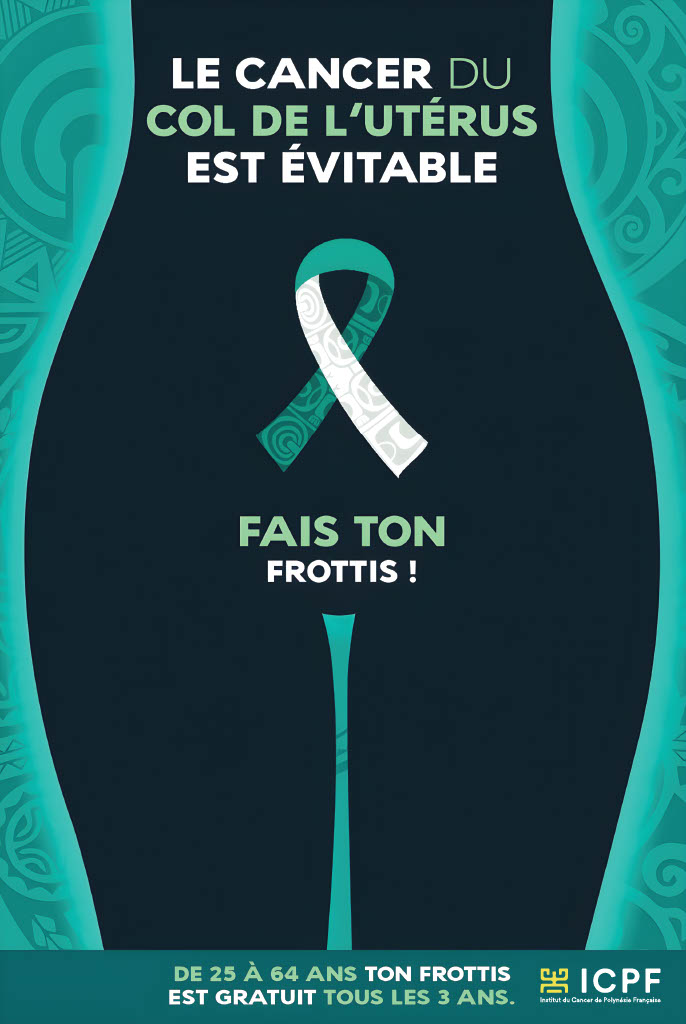 Cancer du col de l'utérus - ICPF